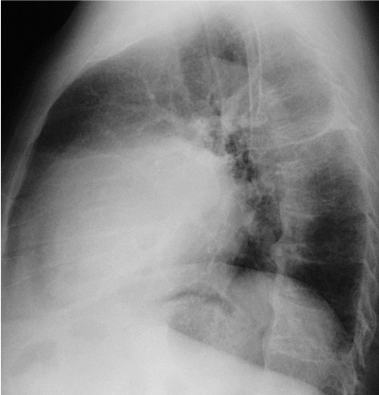 Dr. Pepe’s Diploma Casebook: CASE 122 – SOLVED! – European Diploma of ...