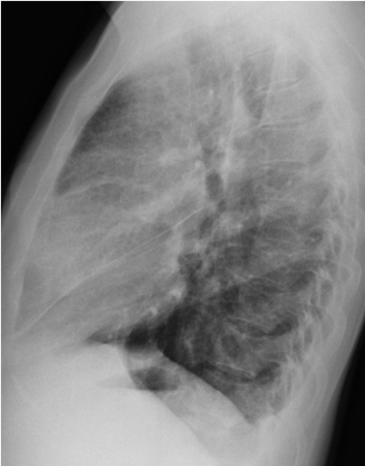 Dr. Pepe’s Diploma Casebook: CASE 126 – SOLVED! – European Diploma of ...