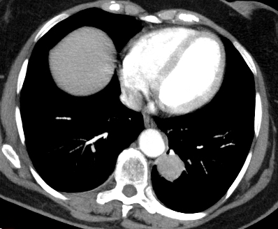 axial ct – European Diploma of Radiology