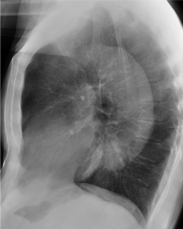 Dr. Pepe’s Diploma Casebook: CASE 136 – SOLVED – European Diploma of ...