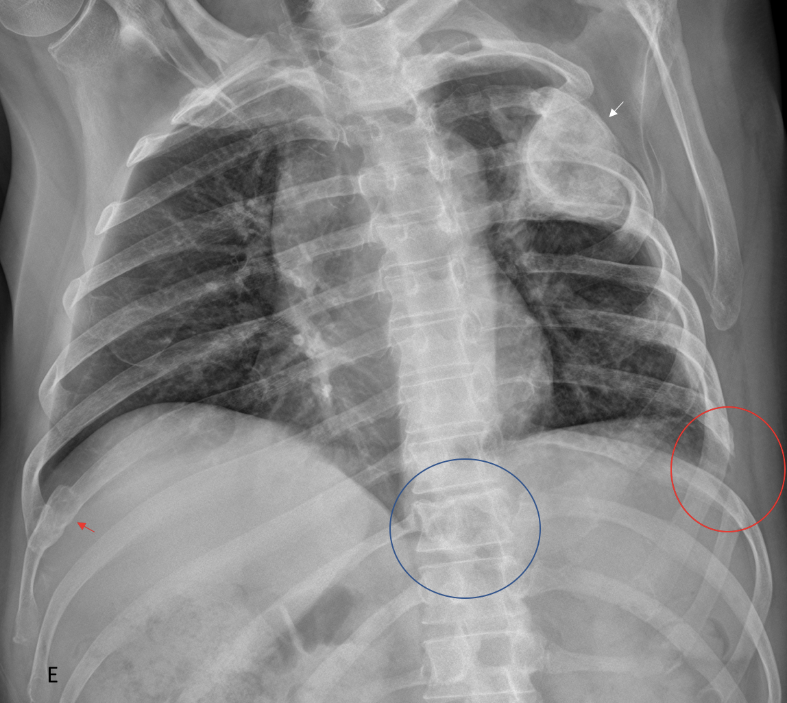 Slide4 – European Diploma of Radiology