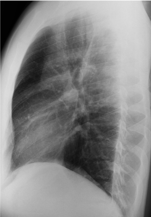 Dr. Pepe’s Diploma Casebook: CASE 142 – Art of interpretation – SOLVED ...