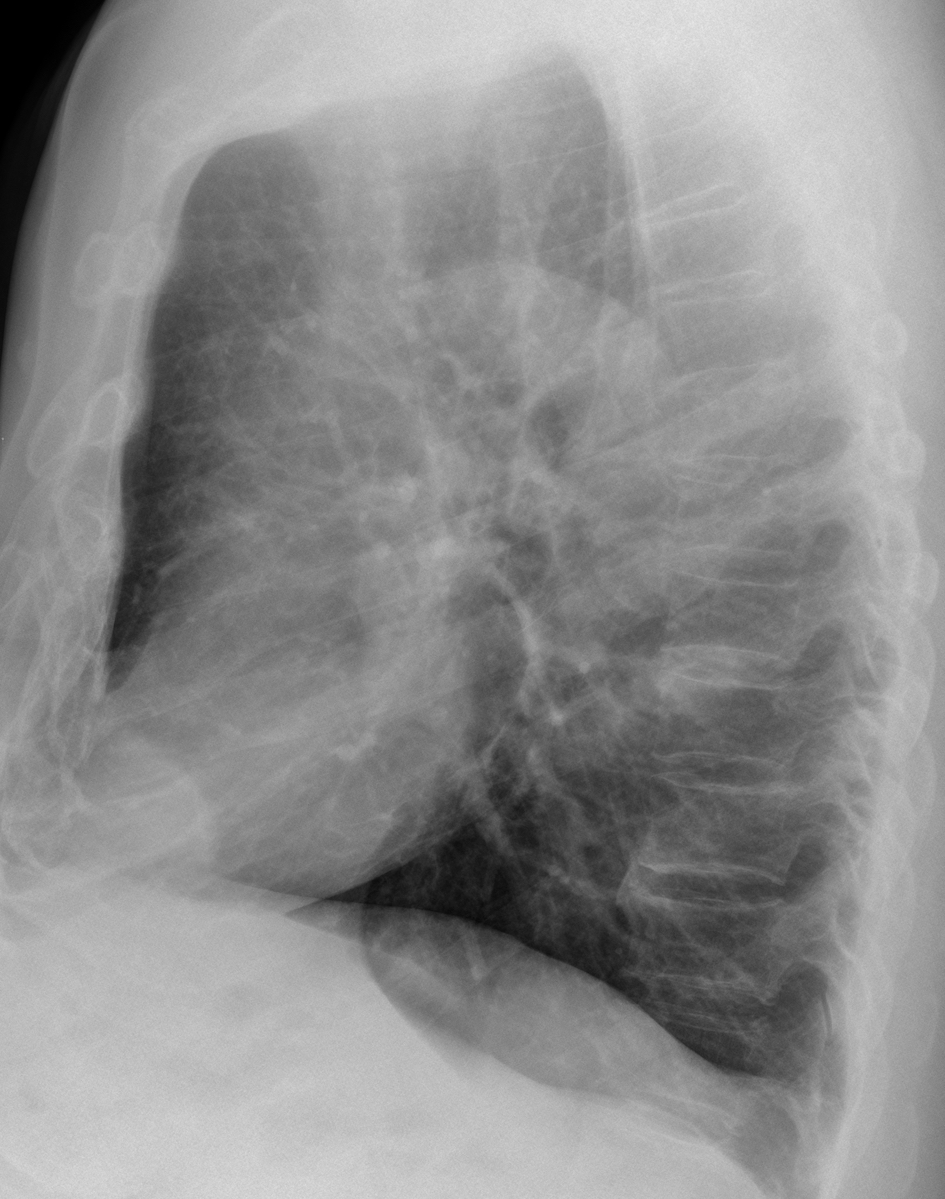 Dr. Pepe’s Diploma Casebook 153 – All you need to know to interpret a ...