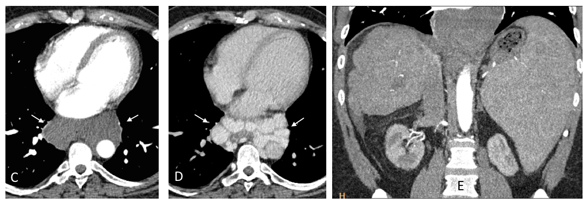 Dr. Pepe’s Diploma Casebook 156 – European Diploma of Radiology