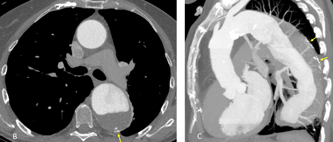 Cáceres Corner Case – Vignette 238 – European Diploma of Radiology