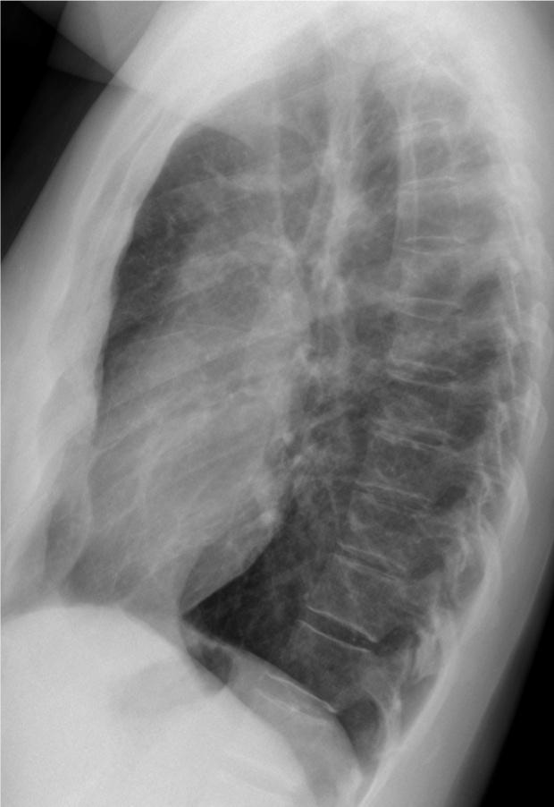 Dr. Pepe’s Diploma Casebook 158 – SOLVED – European Diploma of Radiology