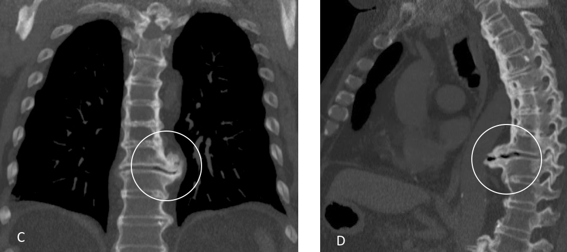 Case163_slide2 – European Diploma of Radiology