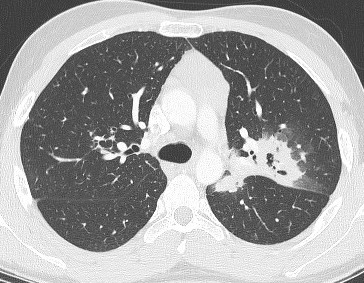axial CT – European Diploma of Radiology