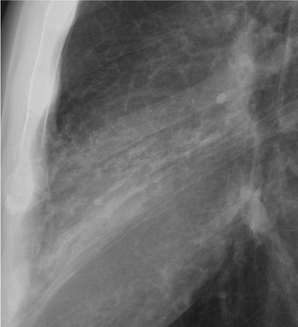 Cáceres’ Corner Case 252 – SOLVED – European Diploma of Radiology