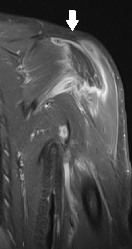 Musculoskeletal #24 – European Diploma of Radiology