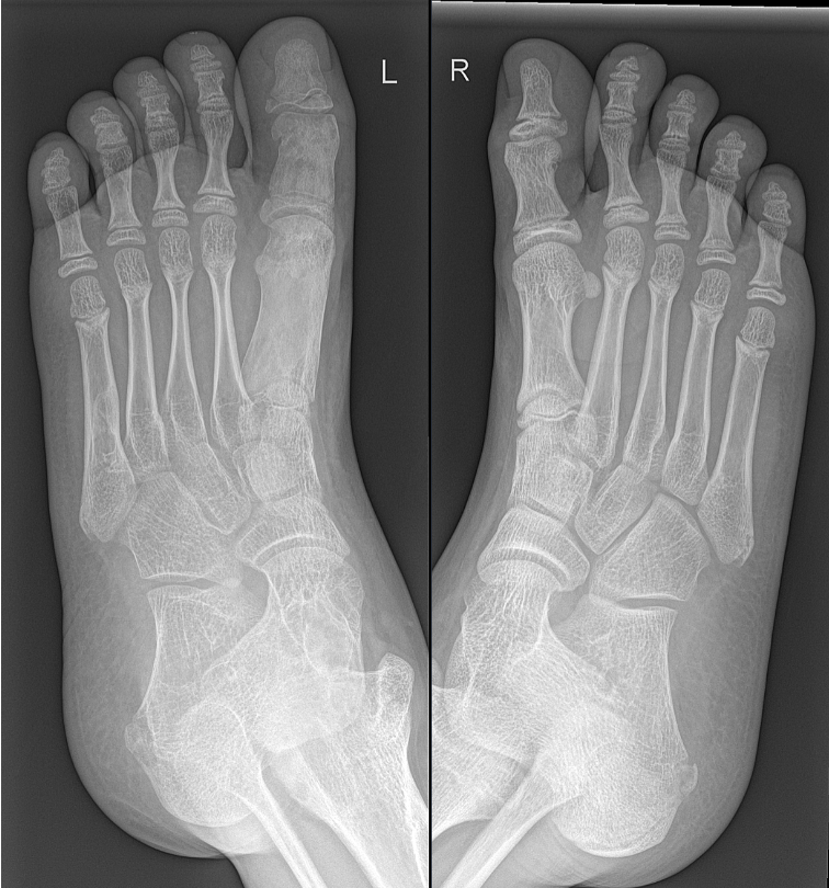 Musculoskeletal #31 – European Diploma of Radiology